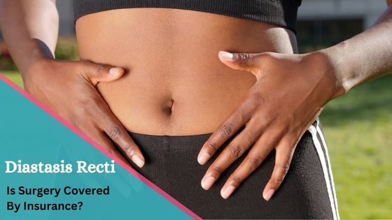 Diastasis Recti Surgery Covered By Insurance? - Little Duniya